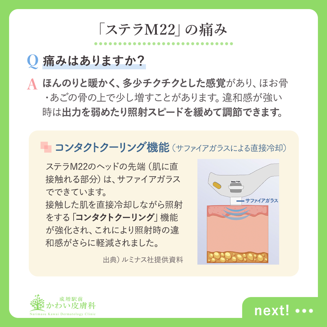 施術Q&A集：フォトフェイシャル®ステラM22～シリーズ4 - 成増駅前かわい皮膚科 | 地下鉄成増駅から徒歩5秒