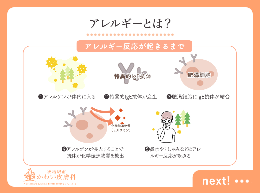 予約不要・保険適用のアレルギー検査～View39 - 板橋区成増駅前かわい皮膚科